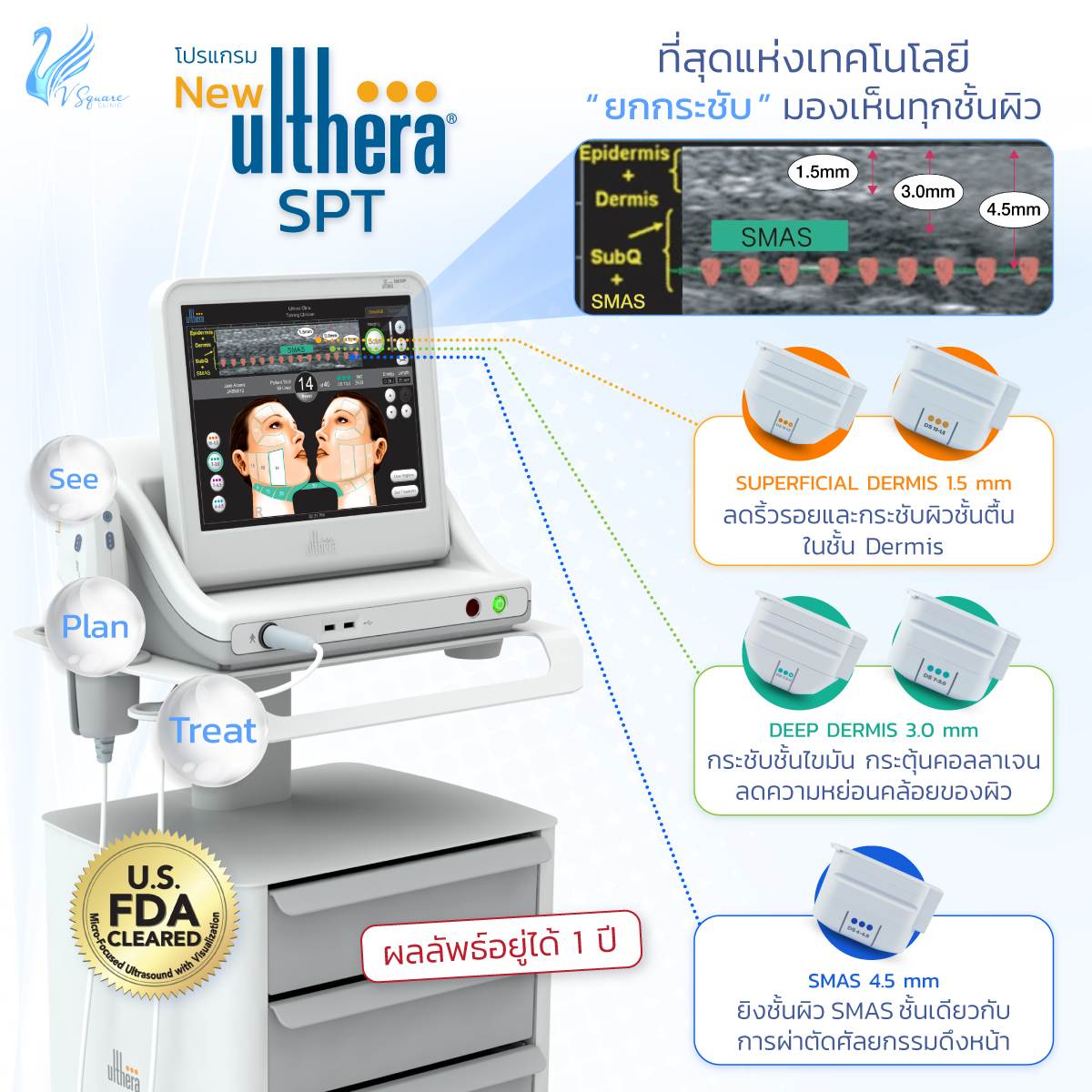 Ulthera คืออะไร มีข้อควรรู้อะไรบ้าง อันตรายหรือไม่ อยู่ได้นานแค่ไหน