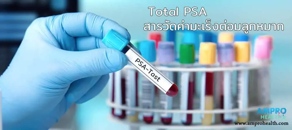 Total PSA คืออะไร? การตรวจวัดค่ามะเร็งต่อมลูกหมาก - AM Pro Health