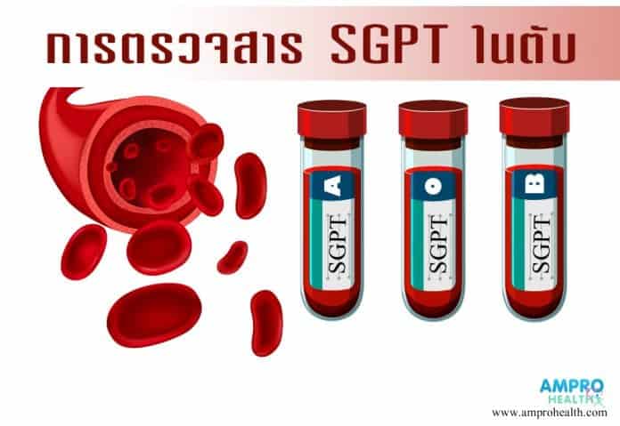 Serum Glutamic Pyruvate Transaminase (SGPT) คืออะไร? ค่าตับที่ควรรู้ ...