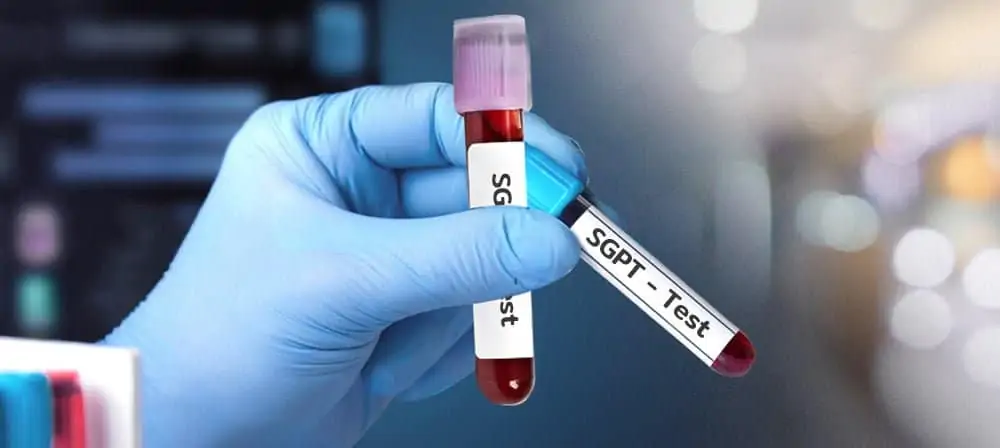 Serum Glutamic Pyruvate Transaminase (SGPT) คืออะไร? ค่าตับที่ควรรู้ ...