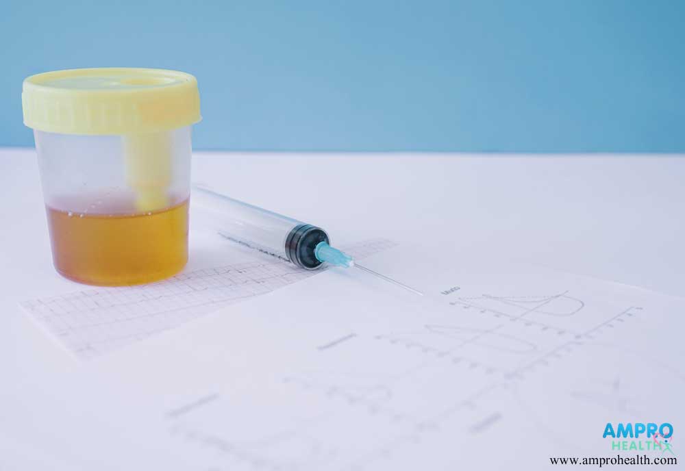 Urine Magnesium คืออะไร? ความสำคัญและการตรวจหาความผิดปกติ - AM Pro Health