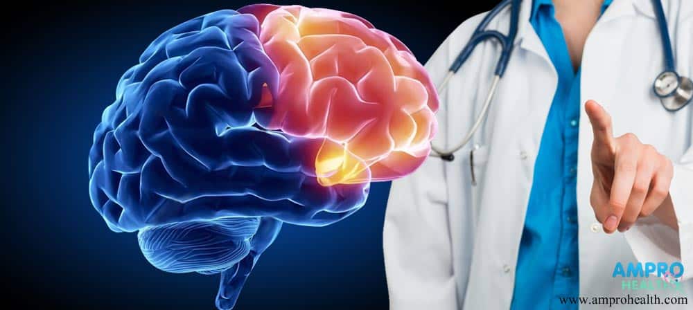 ภาวะถดถอยทางสมองหรือภาวะเอ็มซีไอ ( MCI ) - AM Pro Health